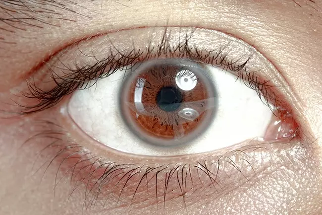 这只眼睛可以讲述你的健康 9175_2