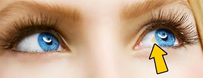 這隻眼睛可以講述你的健康 9175_7