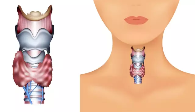 ອາການຂອງພະຍາດ thyroid