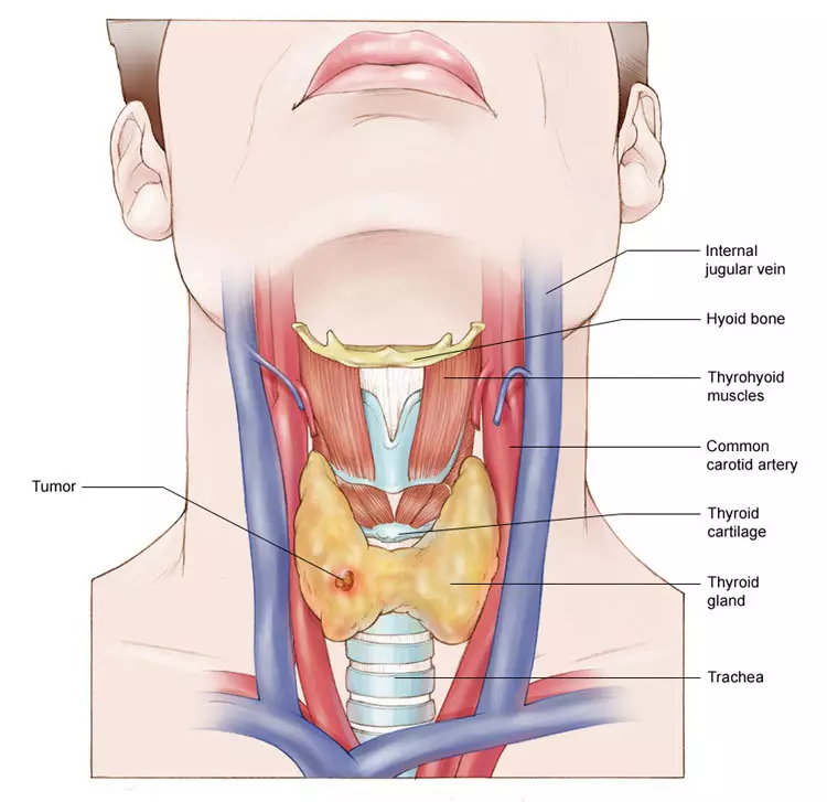 12 segni che devono controllare la ghiandola tiroidea